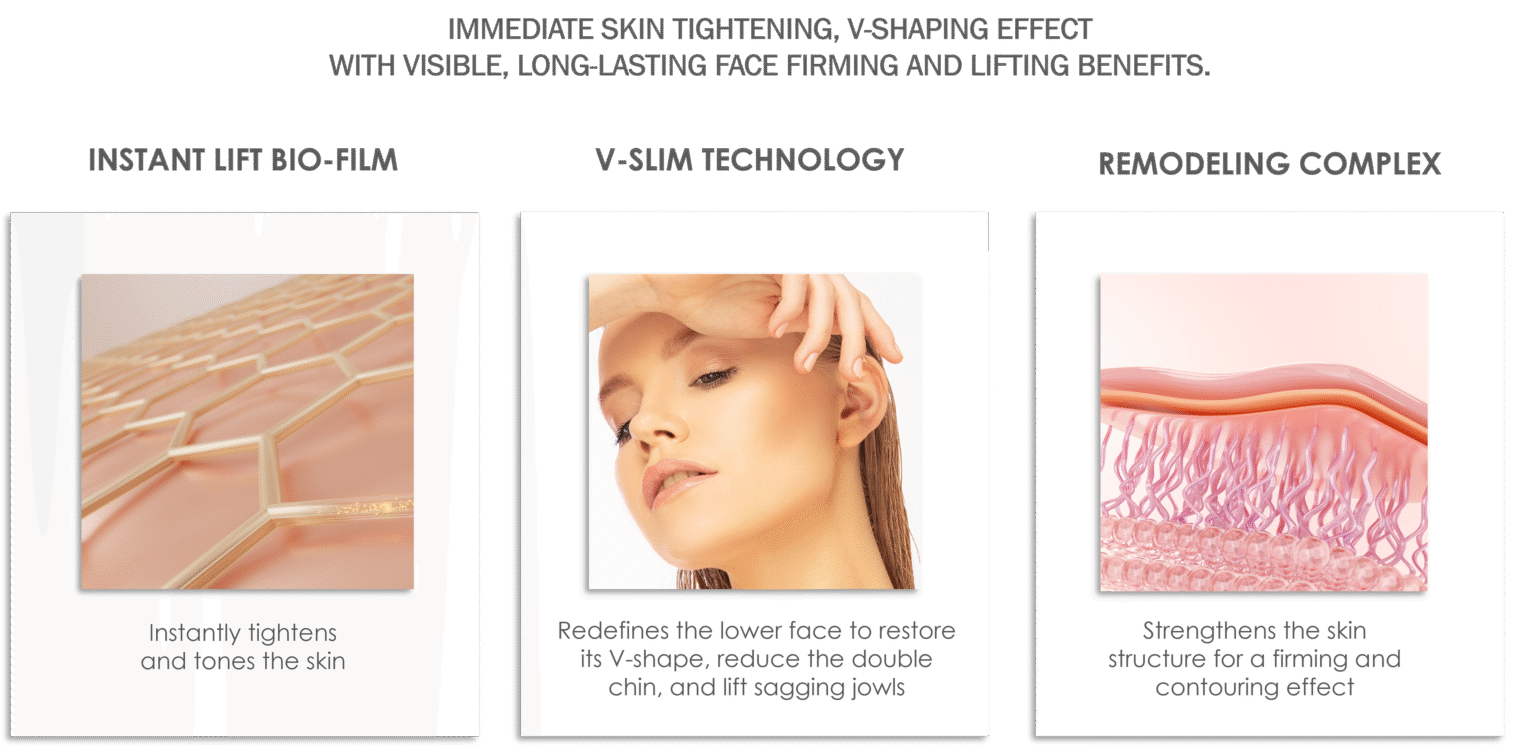 V-Contour Lift - A New Direction in Face-Lifting Treatments.